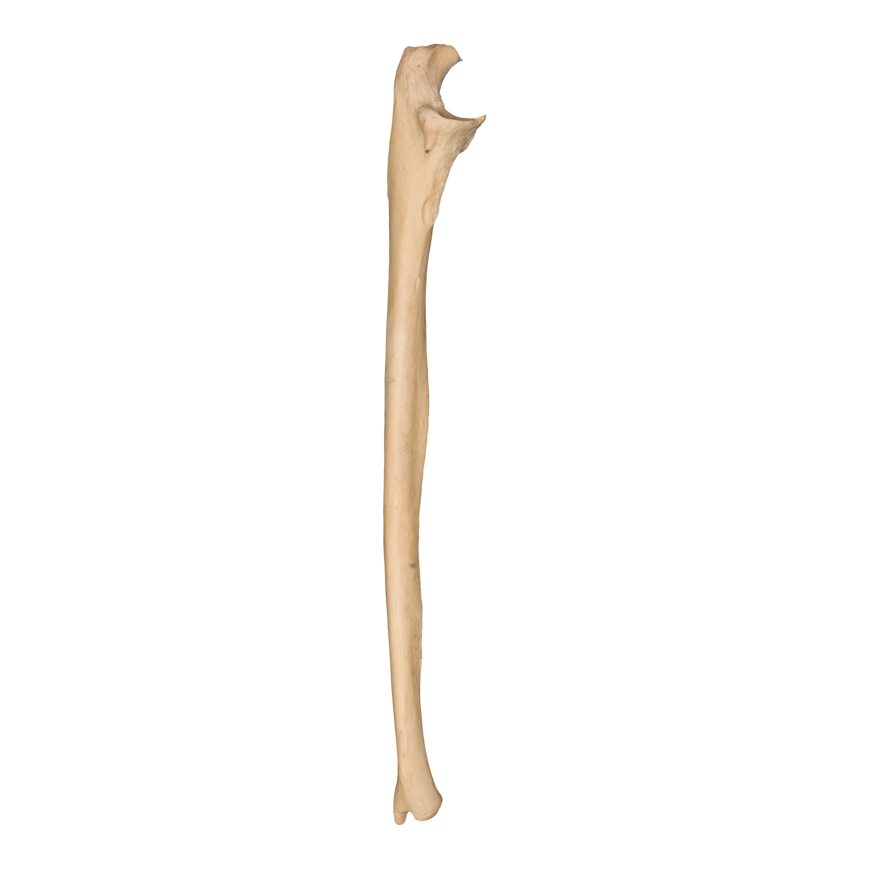 Real Radius Bone