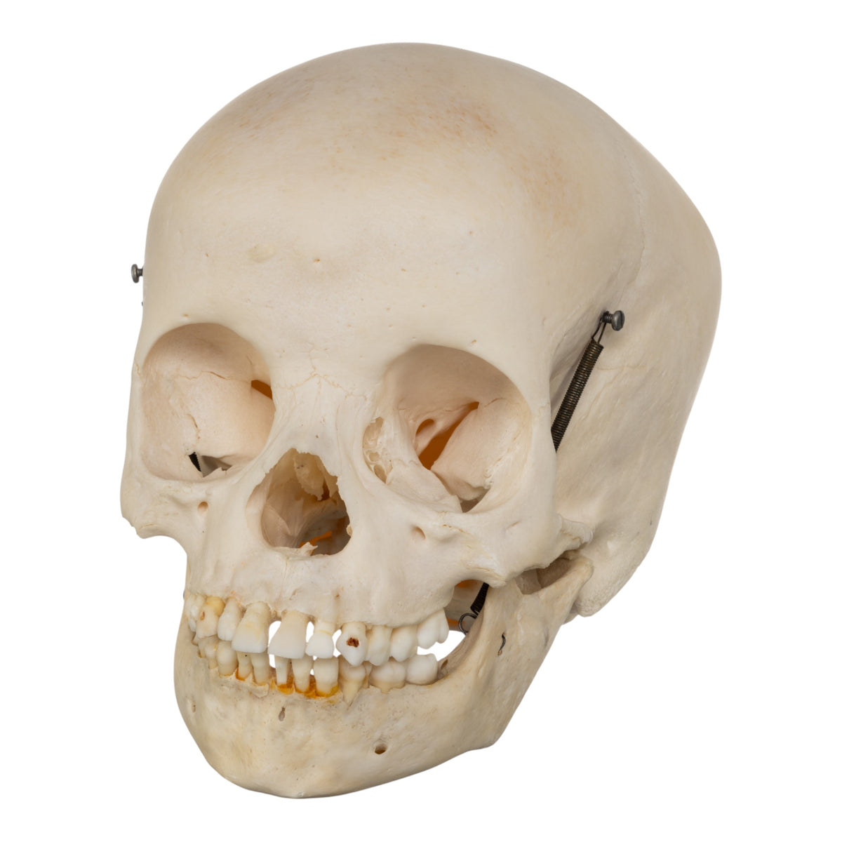 Real Human Child Skull For Sale — Skulls Unlimited International, Inc.