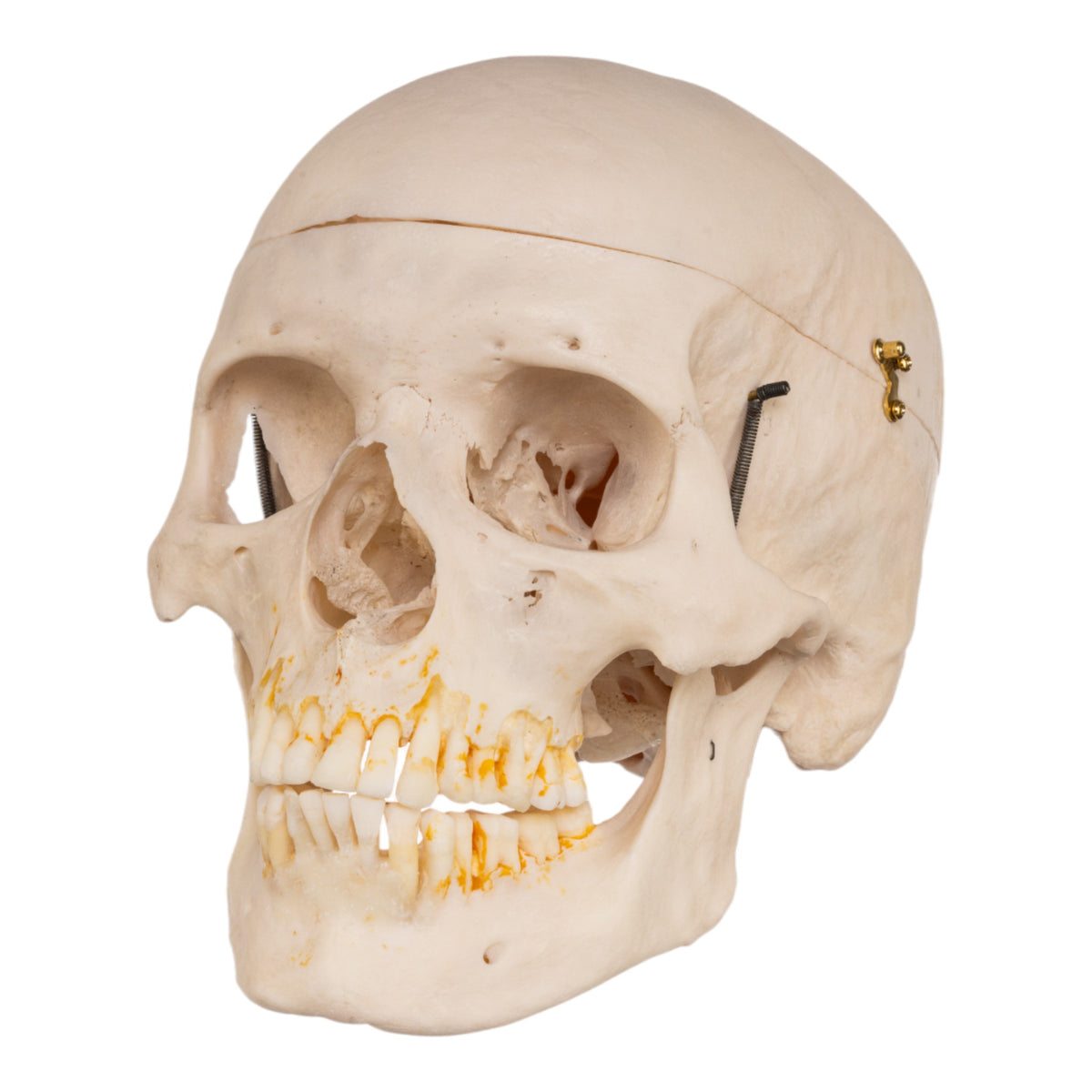 Real Human Skull For Sale — Skulls Unlimited International, Inc.