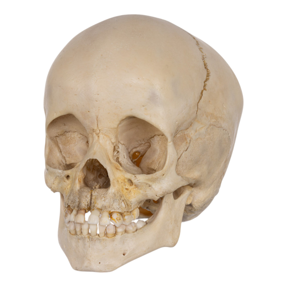 Real Human Child Skull For Sale — Skulls Unlimited International, Inc.