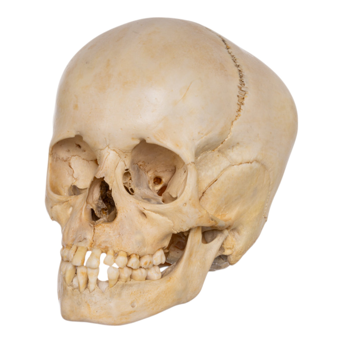 Real Human Child Skull For Sale — Skulls Unlimited International, Inc.