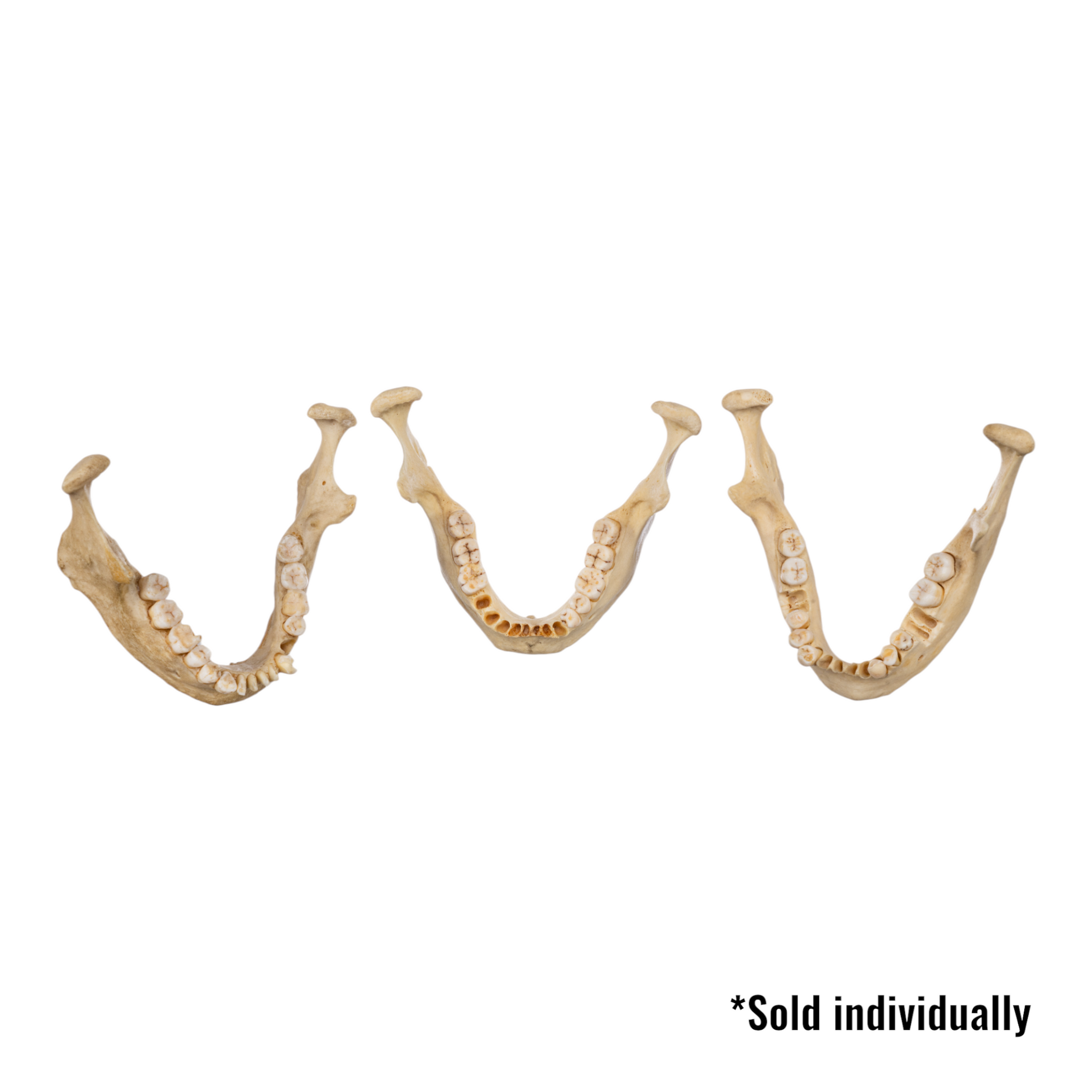 Real Human Mandible For Sale — Skulls Unlimited International, Inc.