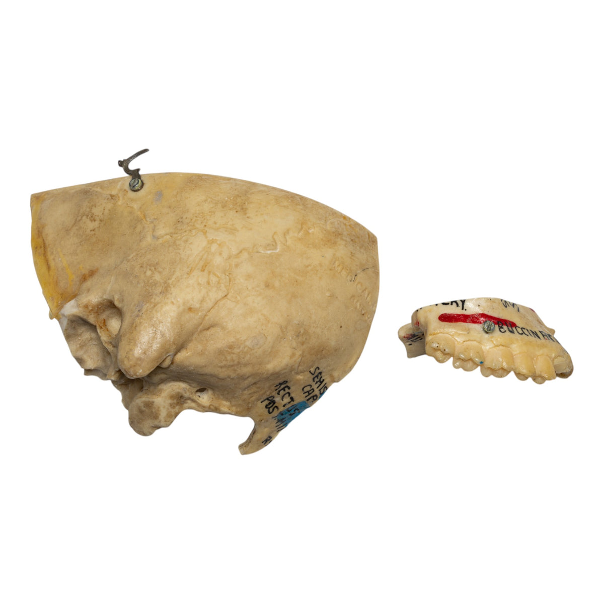 Replica Human Child Partial Skull For Sale — Skulls Unlimited ...