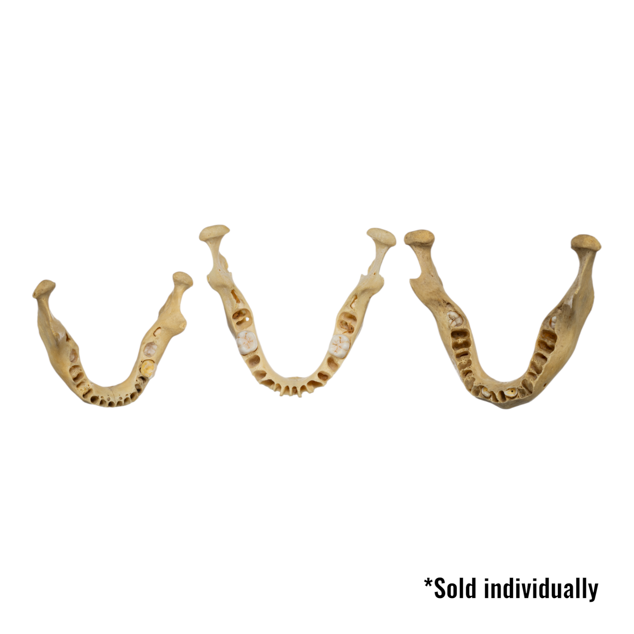Real Human Mandible (Young) For Sale — Skulls Unlimited International, Inc.