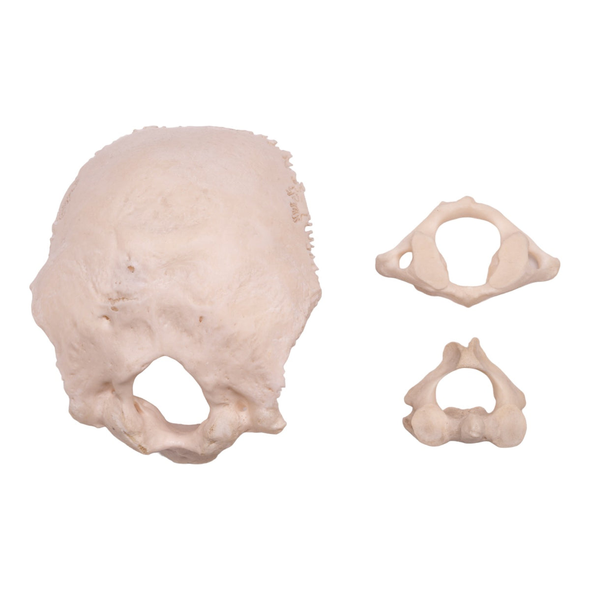 Real Human Occipital Bone, Atlas, and Axis For Sale — Skulls Unlimited ...