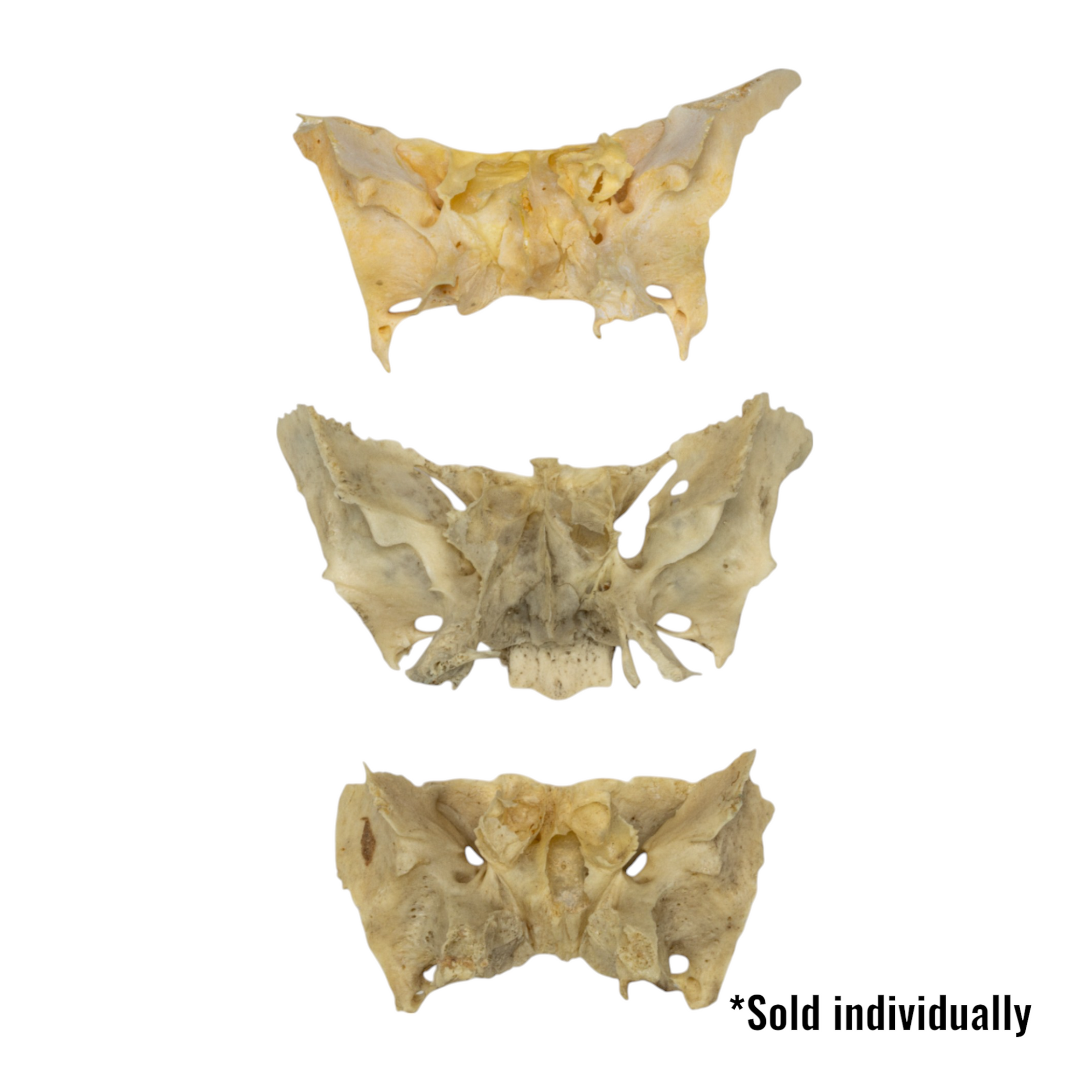 Real Human Sphenoid Bone For Sale — Skulls Unlimited International, Inc.
