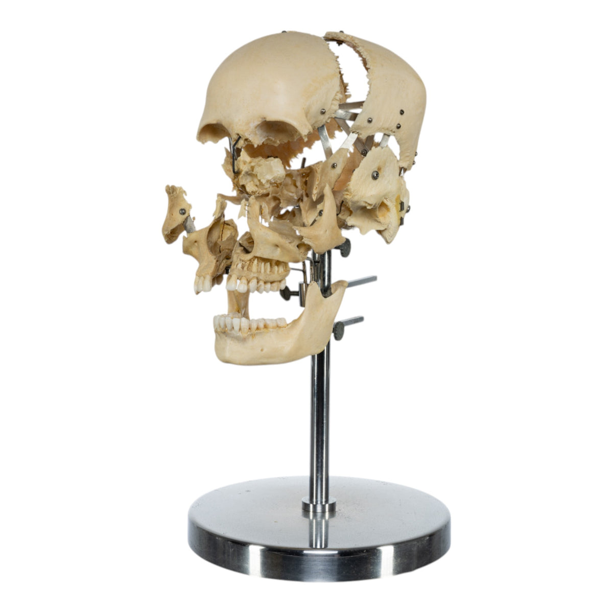 Real Human Exploded Skull On Stand For Sale — Skulls Unlimited ...