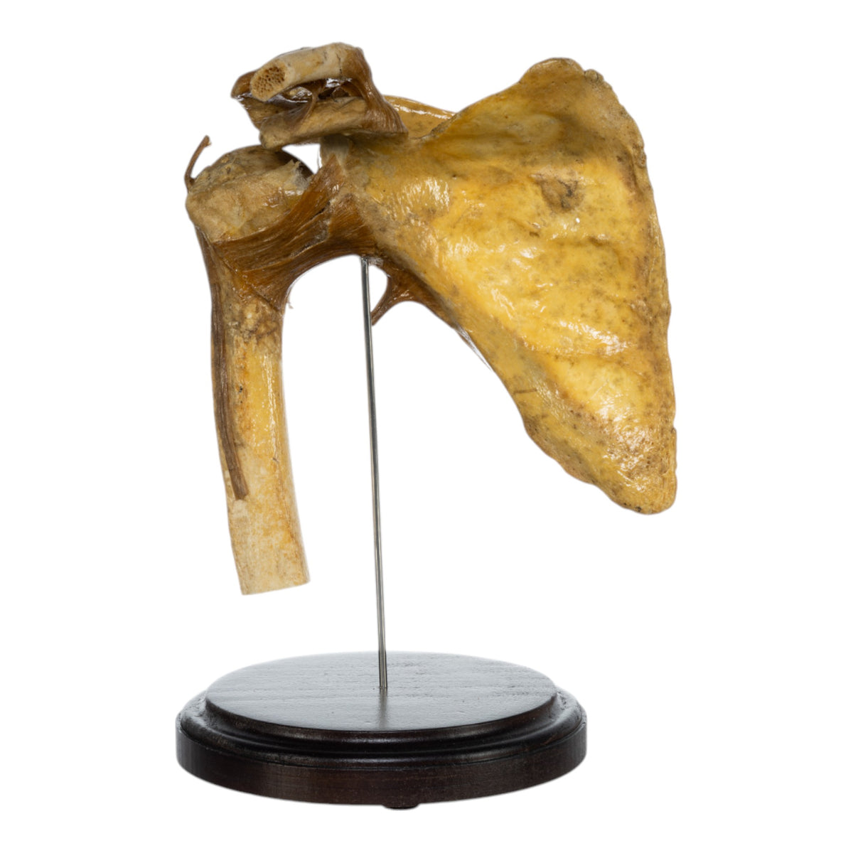 Real Human Right Shoulder Joint On Stand For Sale — Skulls Unlimited ...