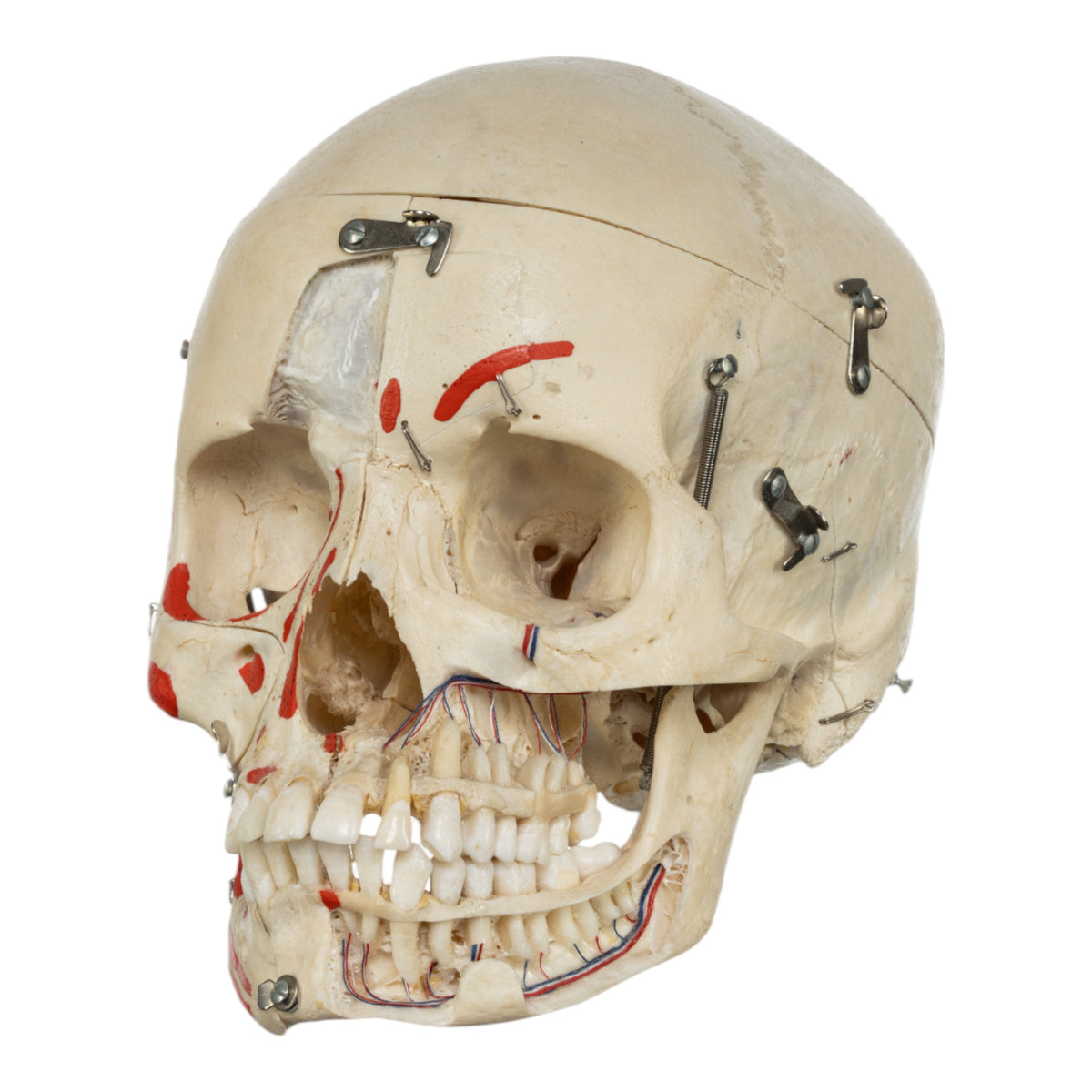Real Dissected Human Skull For Sale — Skulls Unlimited International, Inc.