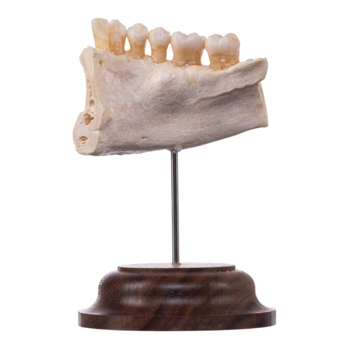 Real Human Partial Mandible On Stand For Sale — Skulls Unlimited ...