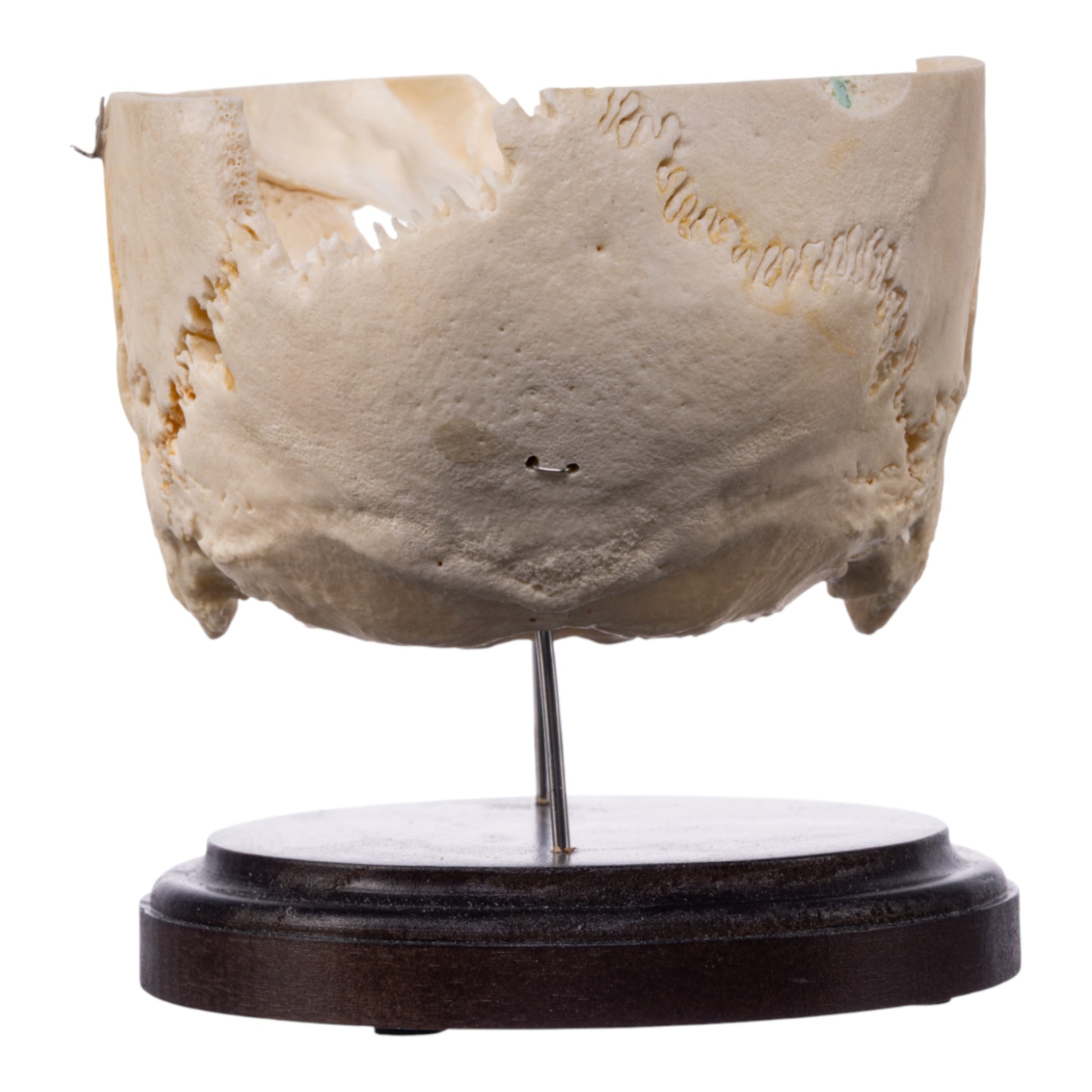 Real Human Skull For Sale — Skulls Unlimited International, Inc.