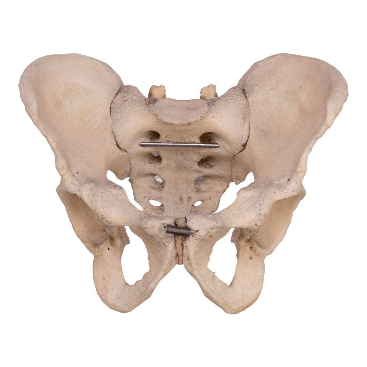 Real Human Pelvis, Sacrum, and Coccyx For Sale — Skulls Unlimited ...