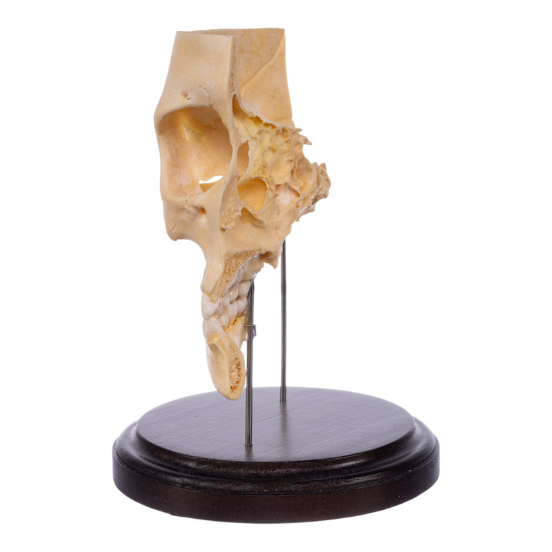 Real Human Skull For Sale — Skulls Unlimited International, Inc.