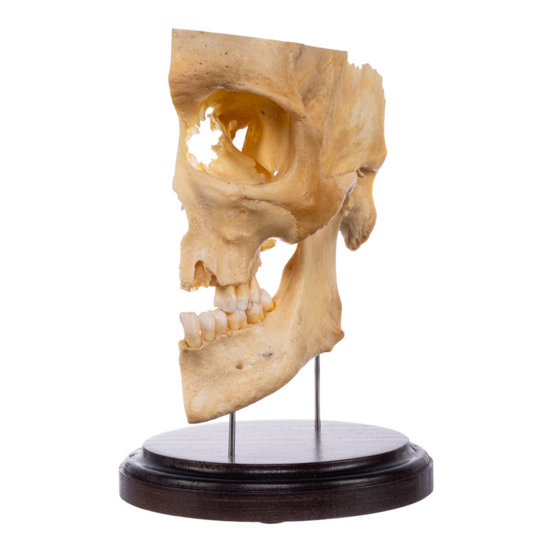 Real Human Skull For Sale — Skulls Unlimited International, Inc.