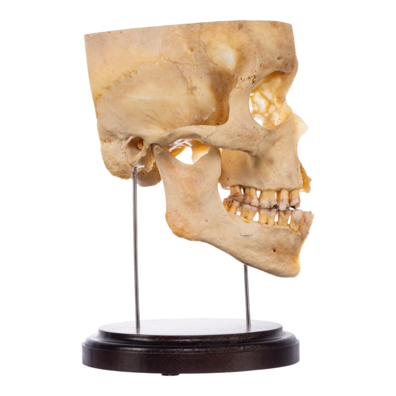 Real Human Skull For Sale — Skulls Unlimited International, Inc.