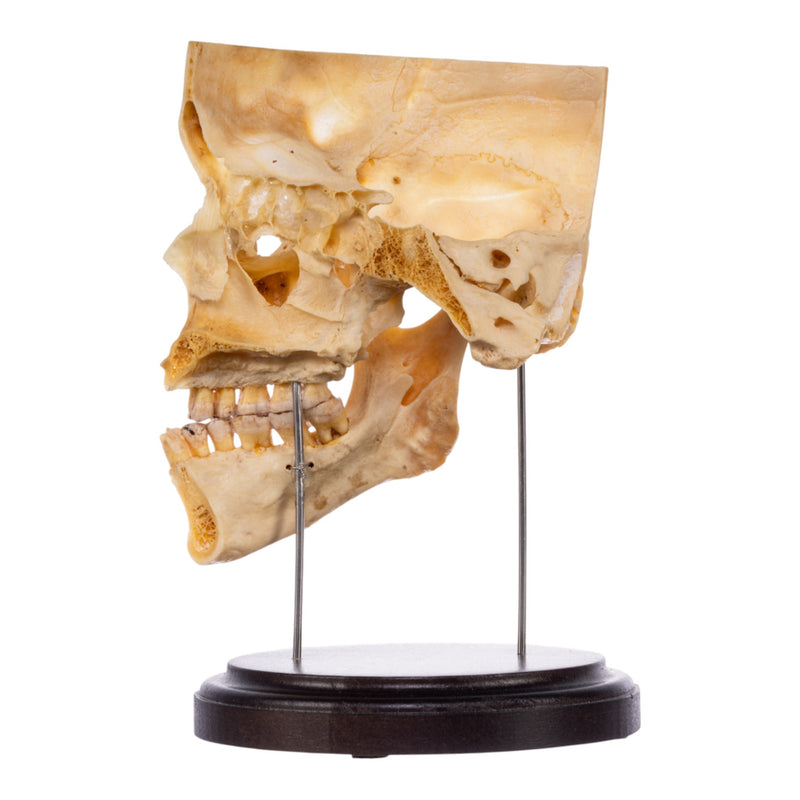Real Human Skull For Sale — Skulls Unlimited International, Inc.