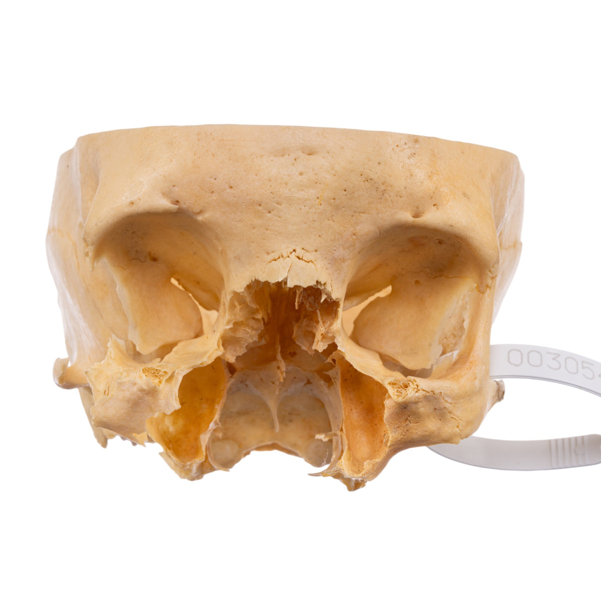 Real Human Partial Skull For Sale — Skulls Unlimited International, Inc.