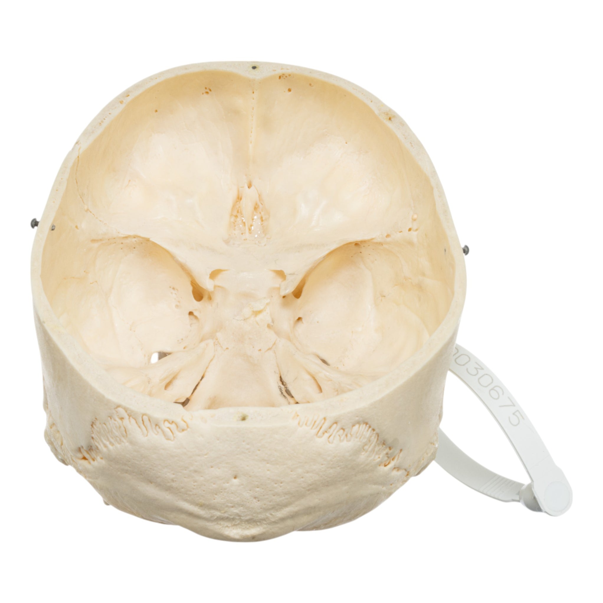 Real Human Partial Skull For Sale — Skulls Unlimited International, Inc.