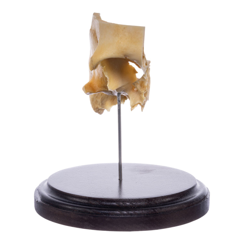 Real Human Skull For Sale — Skulls Unlimited International, Inc.