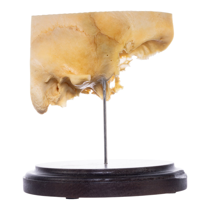Real Human Skull For Sale — Skulls Unlimited International, Inc.