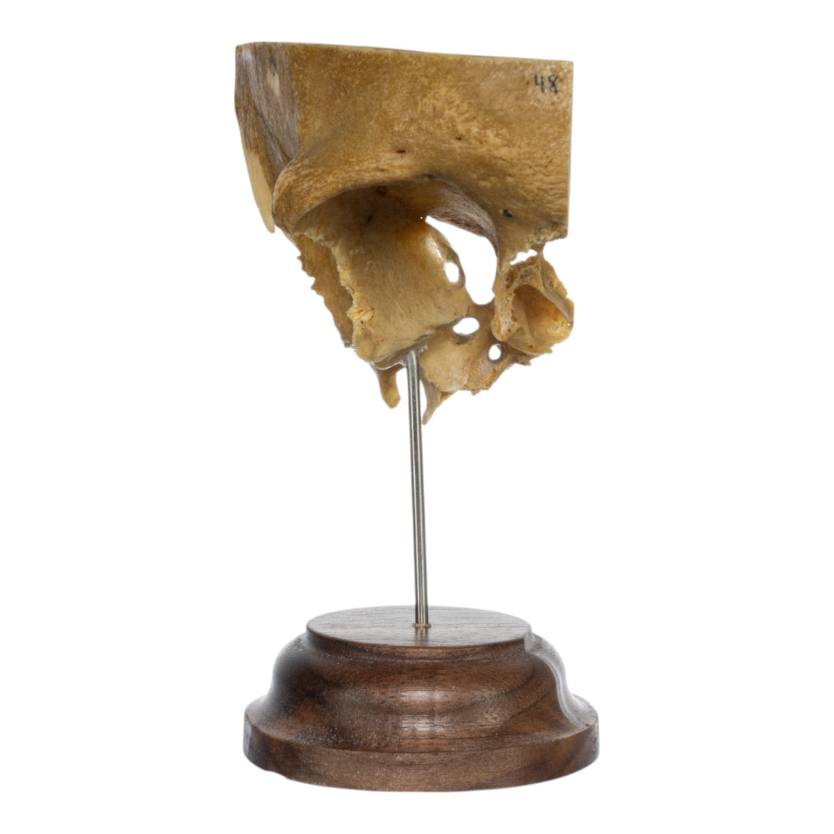 Real Human Partial Skull On Stand For Sale — Skulls Unlimited ...