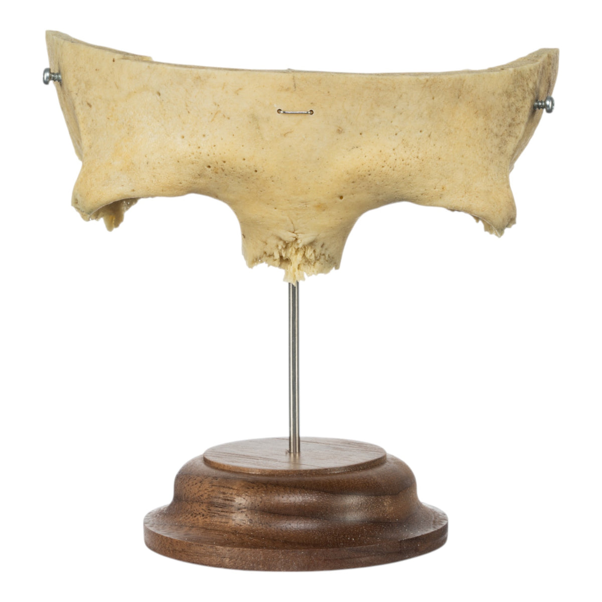 Real Human Partial Frontal Bone On Stand For Sale — Skulls Unlimited ...