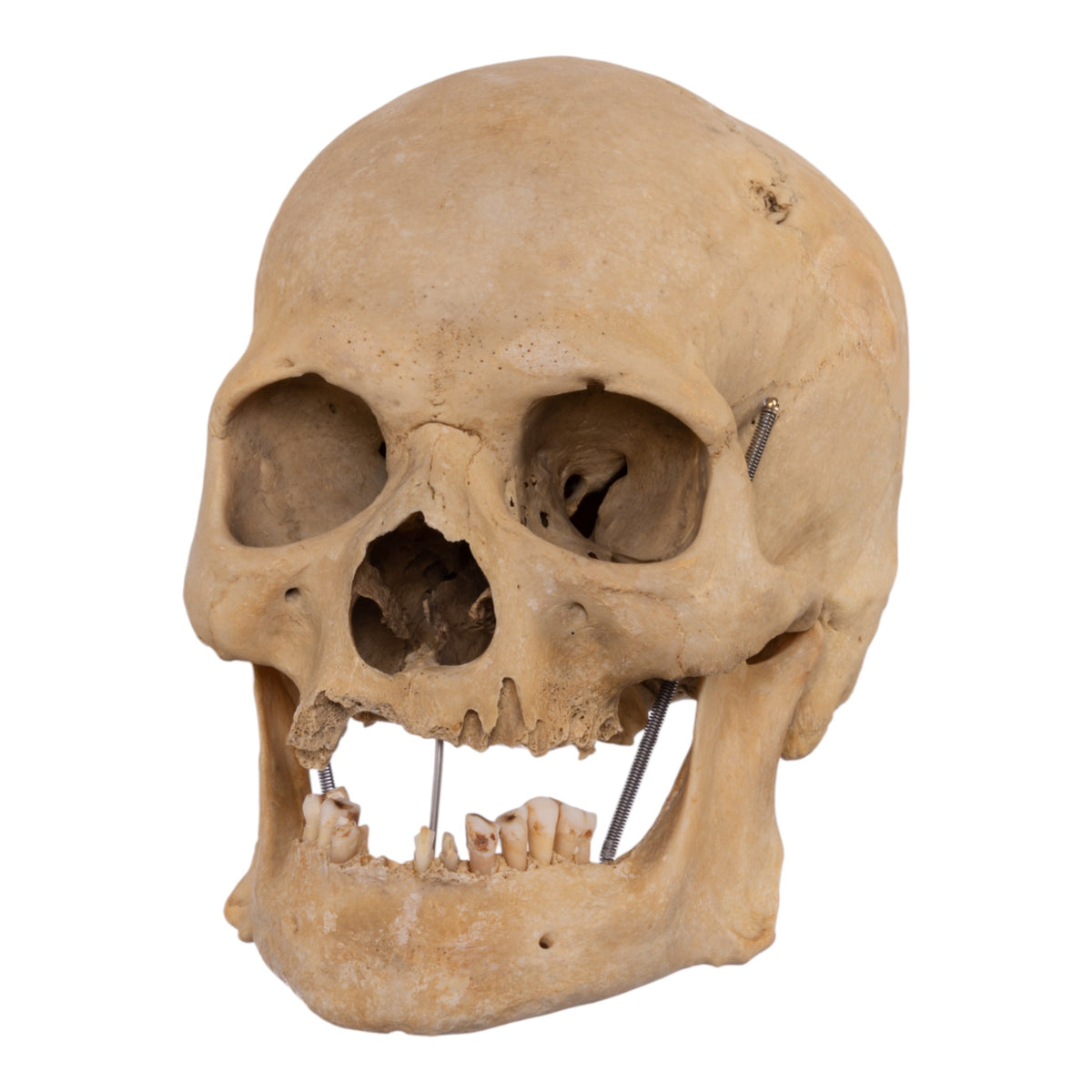 Real Human Skull For Sale — Skulls Unlimited International, Inc.