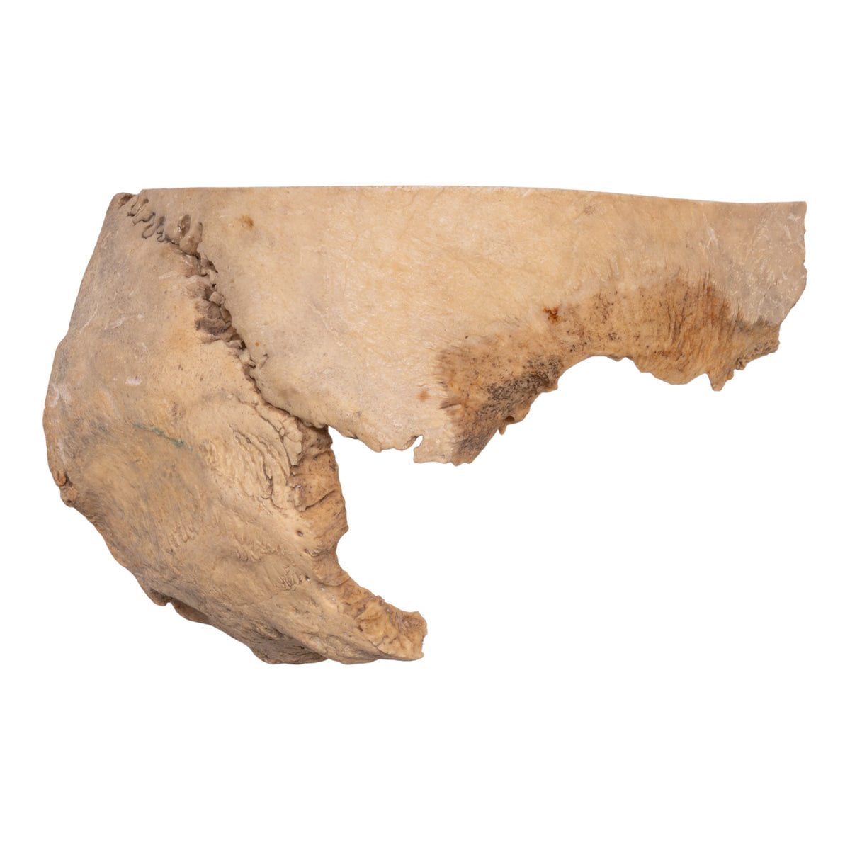 Real Human Partial Skull For Sale — Skulls Unlimited International, Inc.