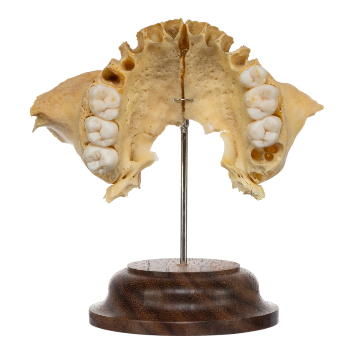 Real Human Partial Skull On Stand For Sale — Skulls Unlimited ...