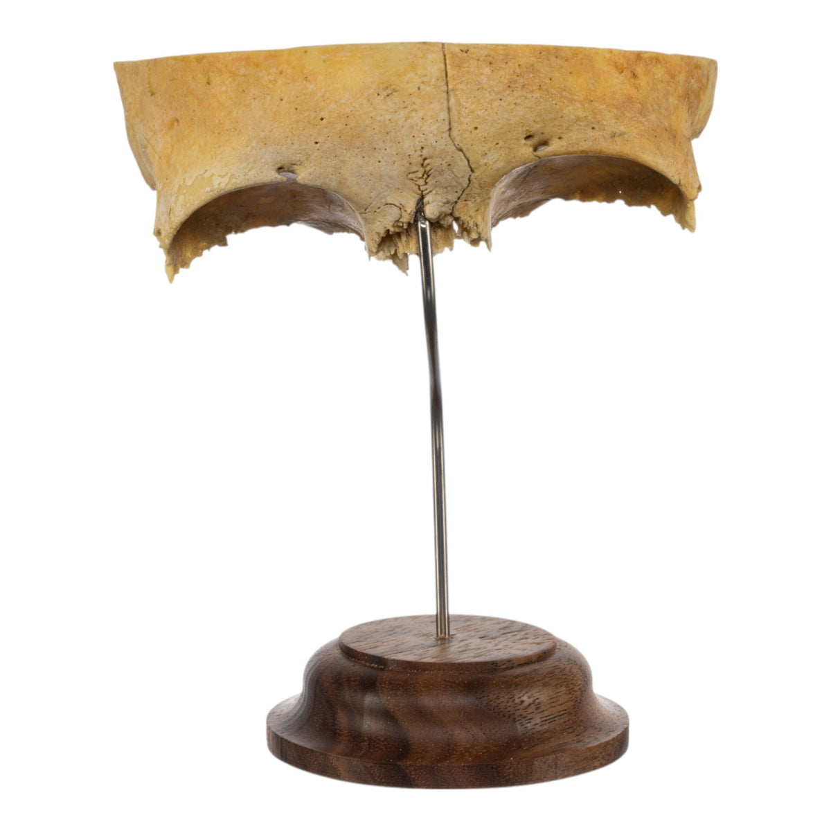 Real Human Partial Skull On Stand For Sale — Skulls Unlimited ...
