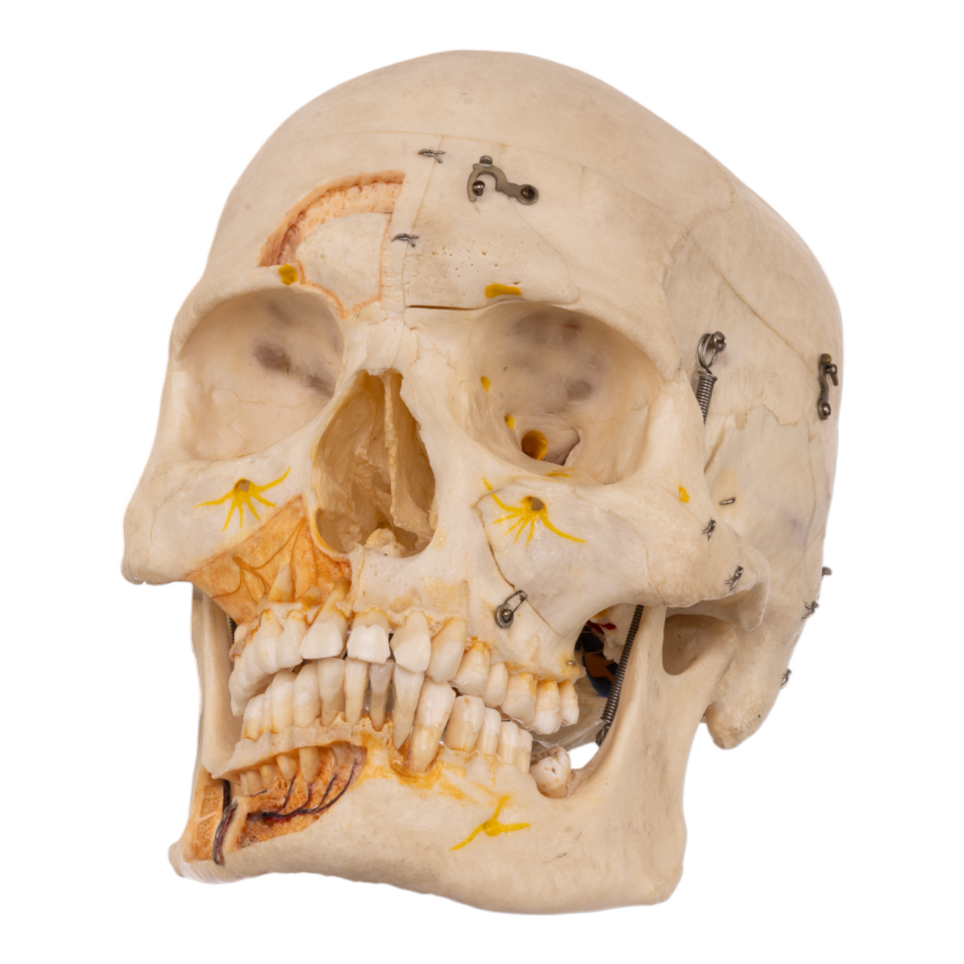 Real Human Skull with Carrying Case - Dissected For Sale — Skulls ...