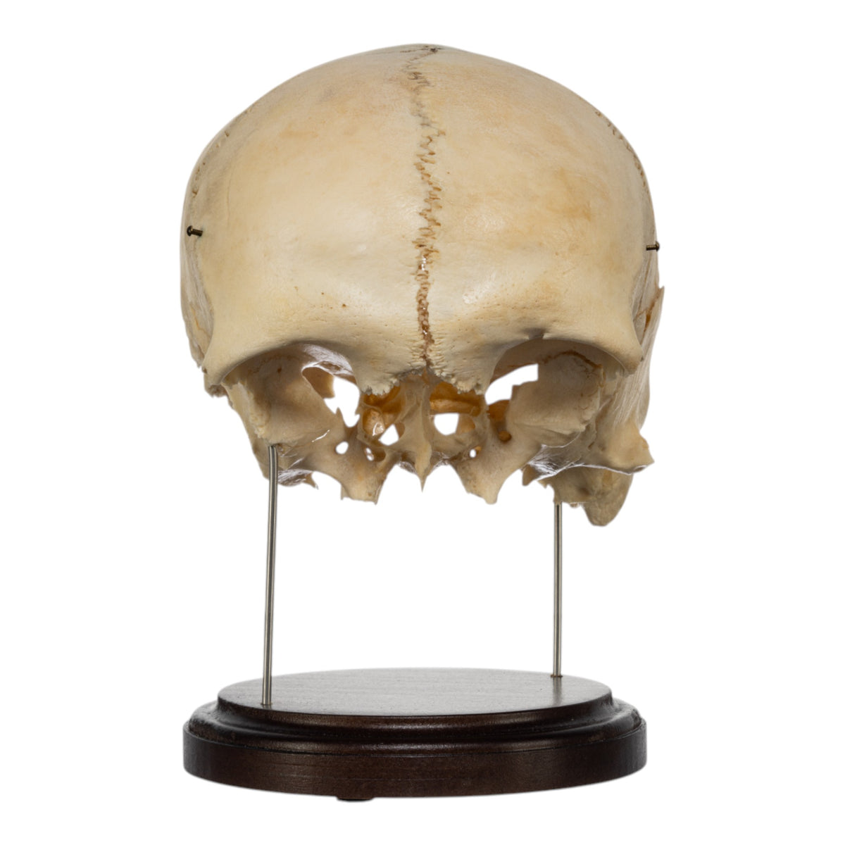 Real Human Partial Skull On Stand For Sale — Skulls Unlimited ...