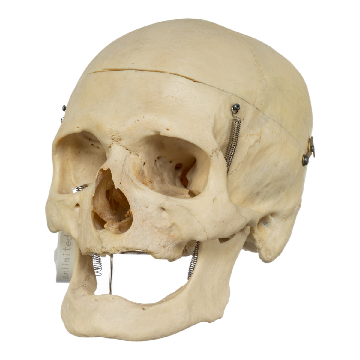 Real Human Skull For Sale — Skulls Unlimited International, Inc.