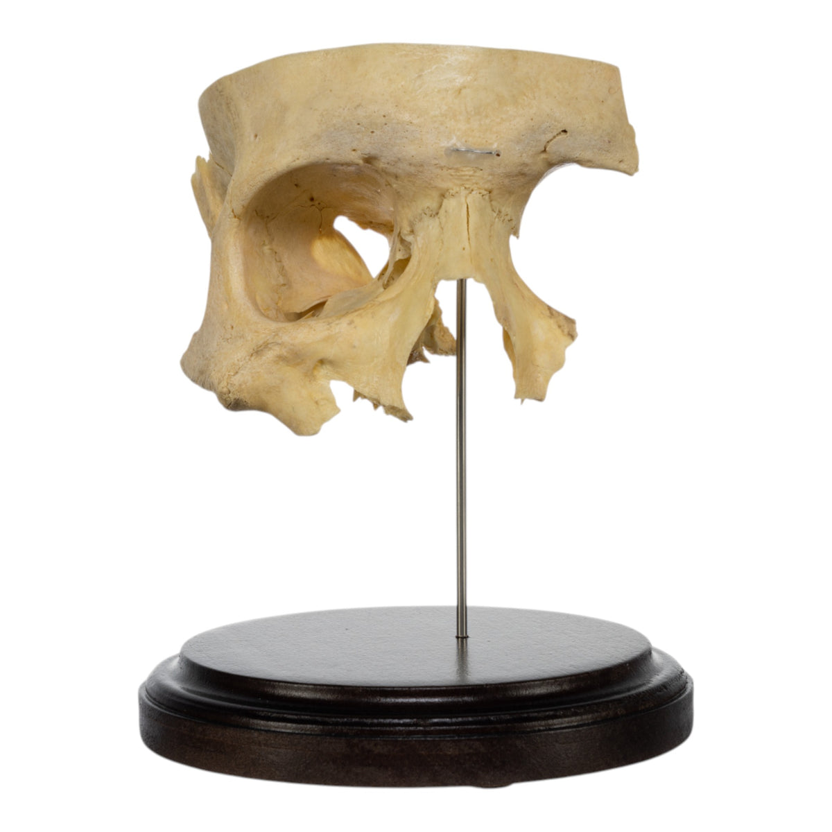 Real Human Partial Skull on Stand For Sale — Skulls Unlimited ...