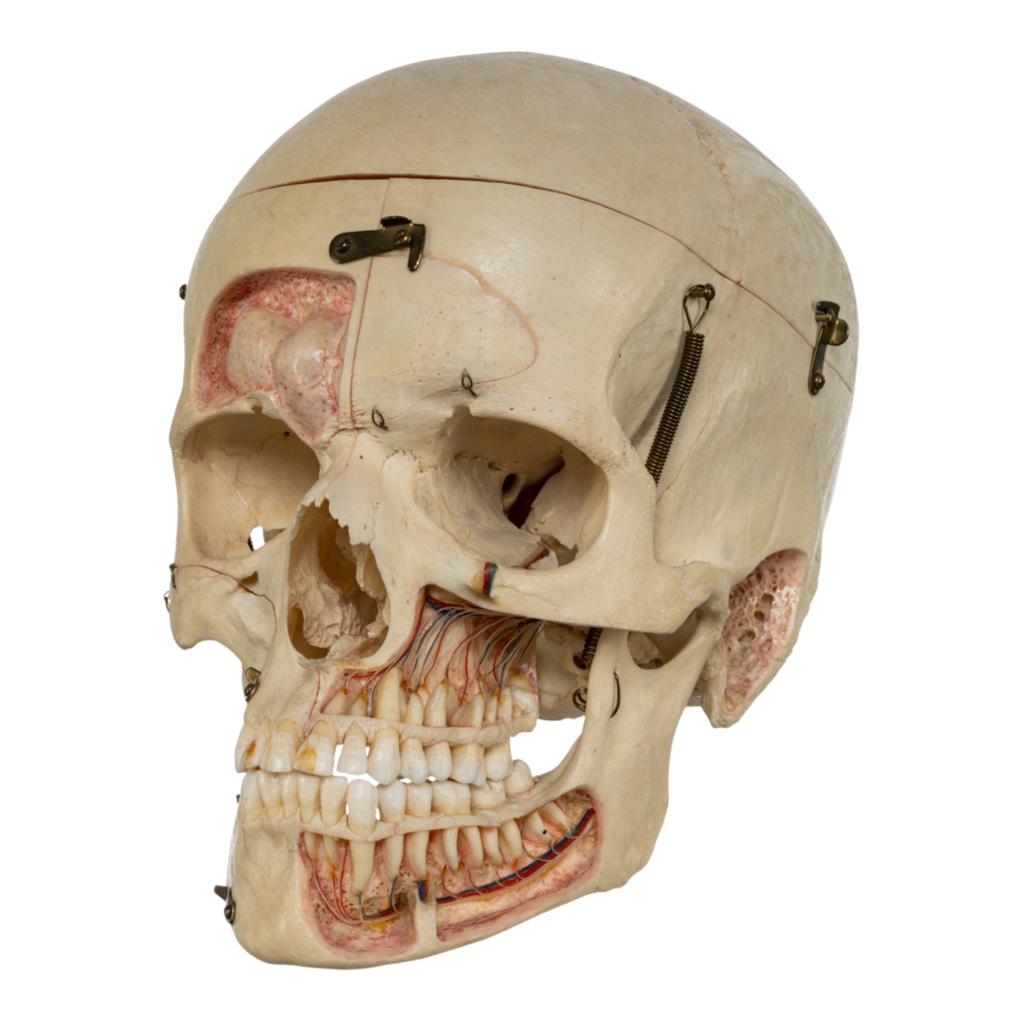 Real Human Dissected Skull in Carrying Case For Sale — Skulls Unlimited ...