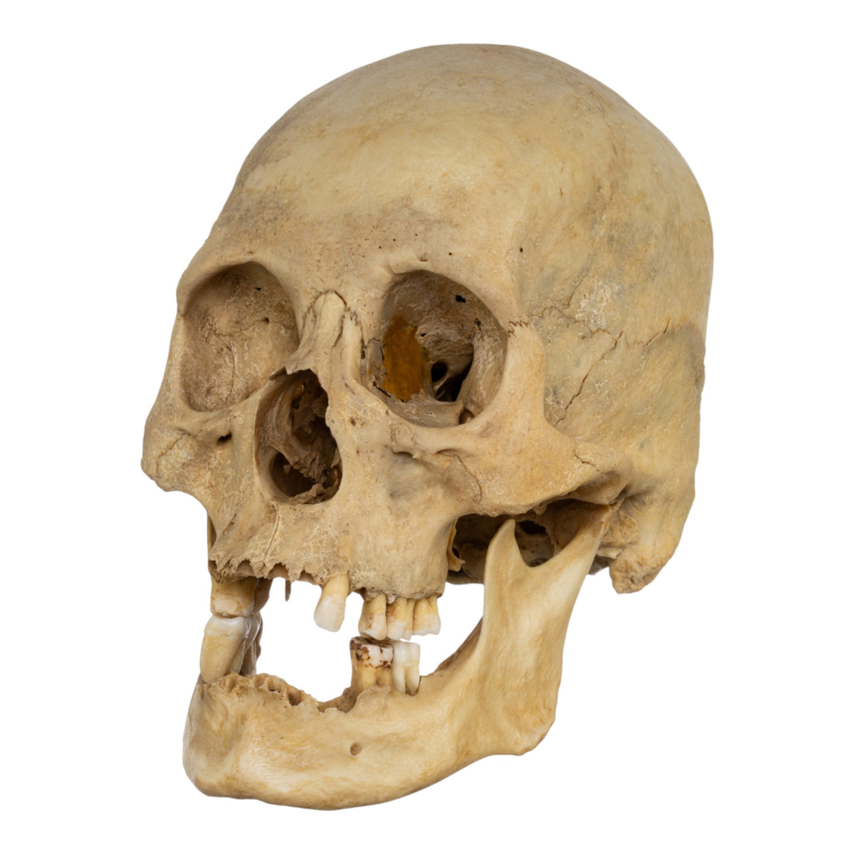 Real Human Skull For Sale — Skulls Unlimited International, Inc.