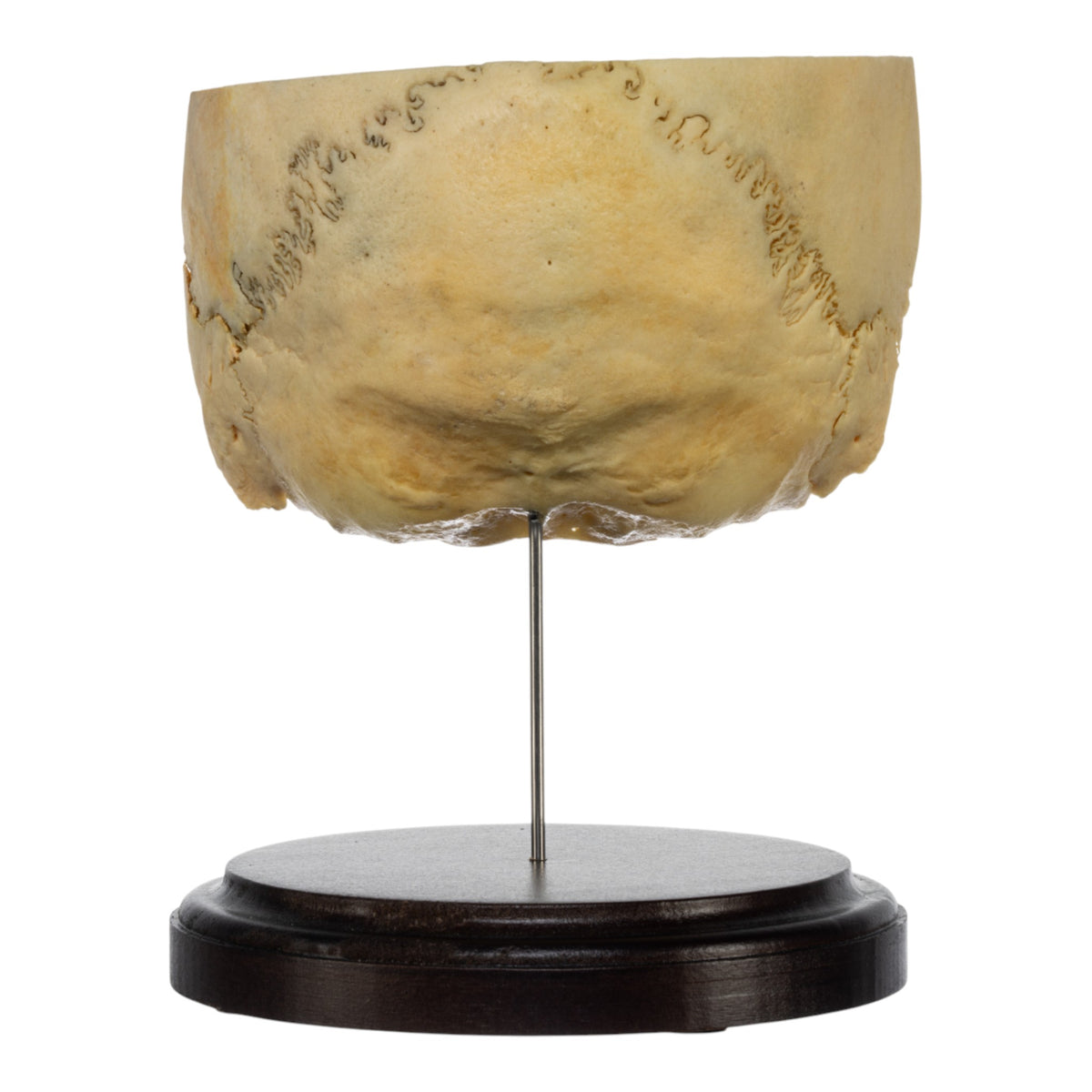 Real Human Partial Skull On Stand For Sale — Skulls Unlimited ...