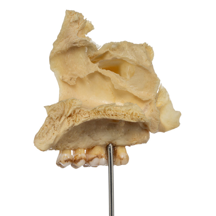 Real Human Maxillary Bone On Stand For Sale — Skulls Unlimited ...