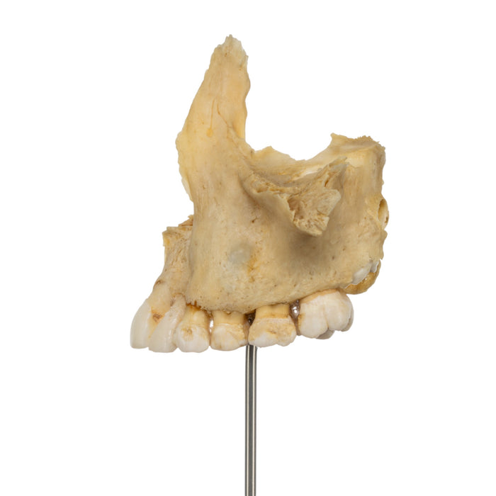 Real Human Partial Maxillary Bone on Stand For Sale — Skulls Unlimited ...