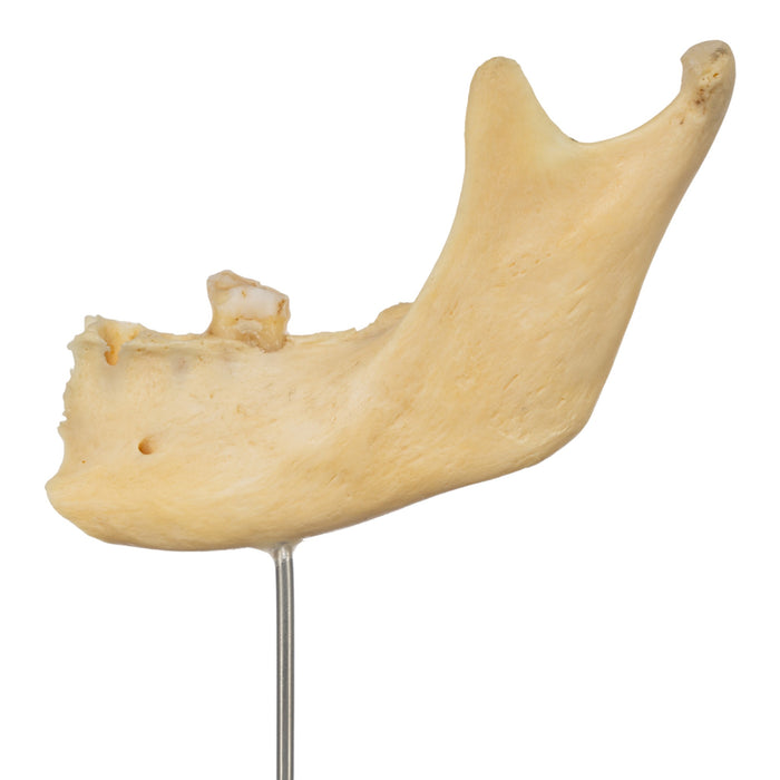 Real Human Partial Mandible on Stand For Sale — Skulls Unlimited ...