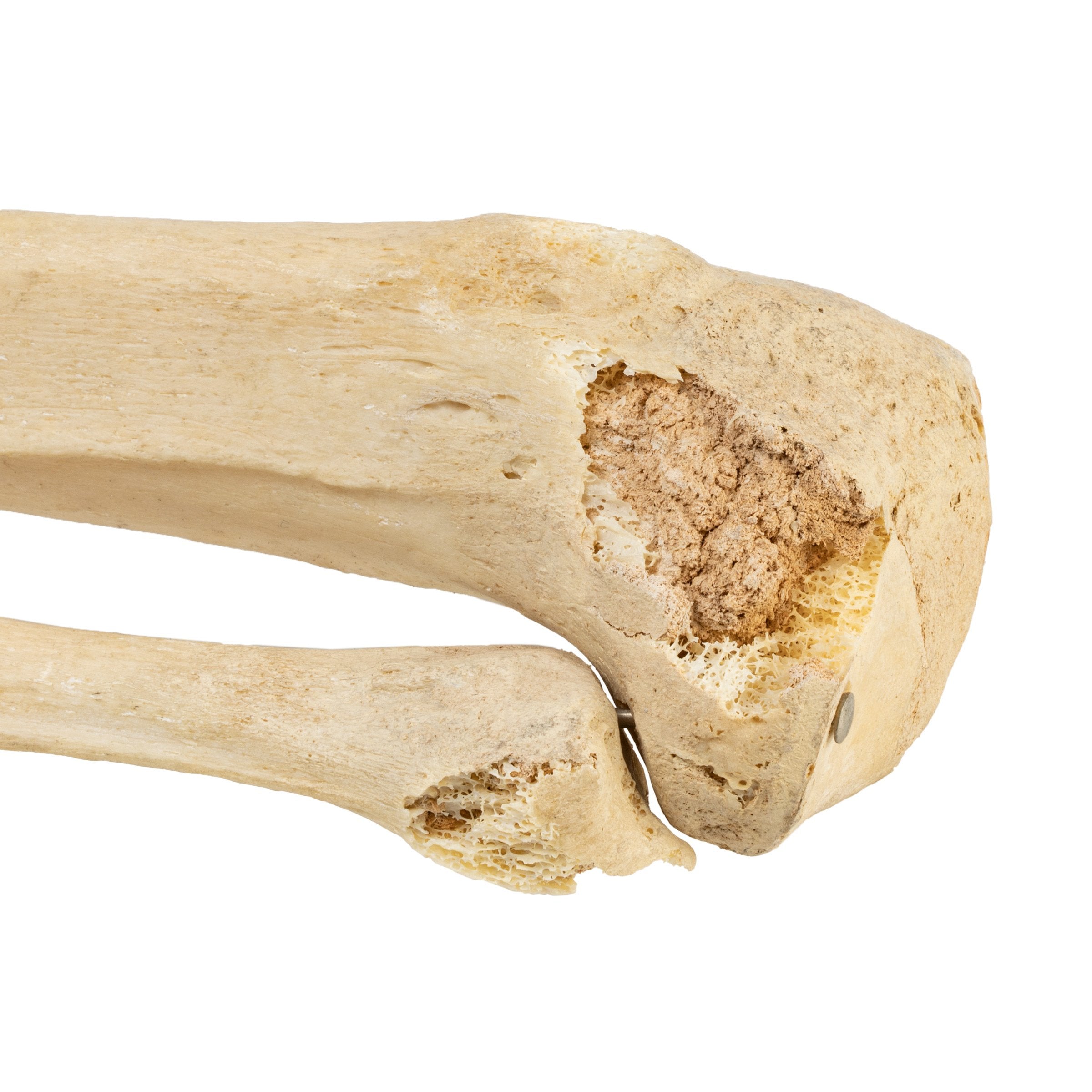 Human Tibia