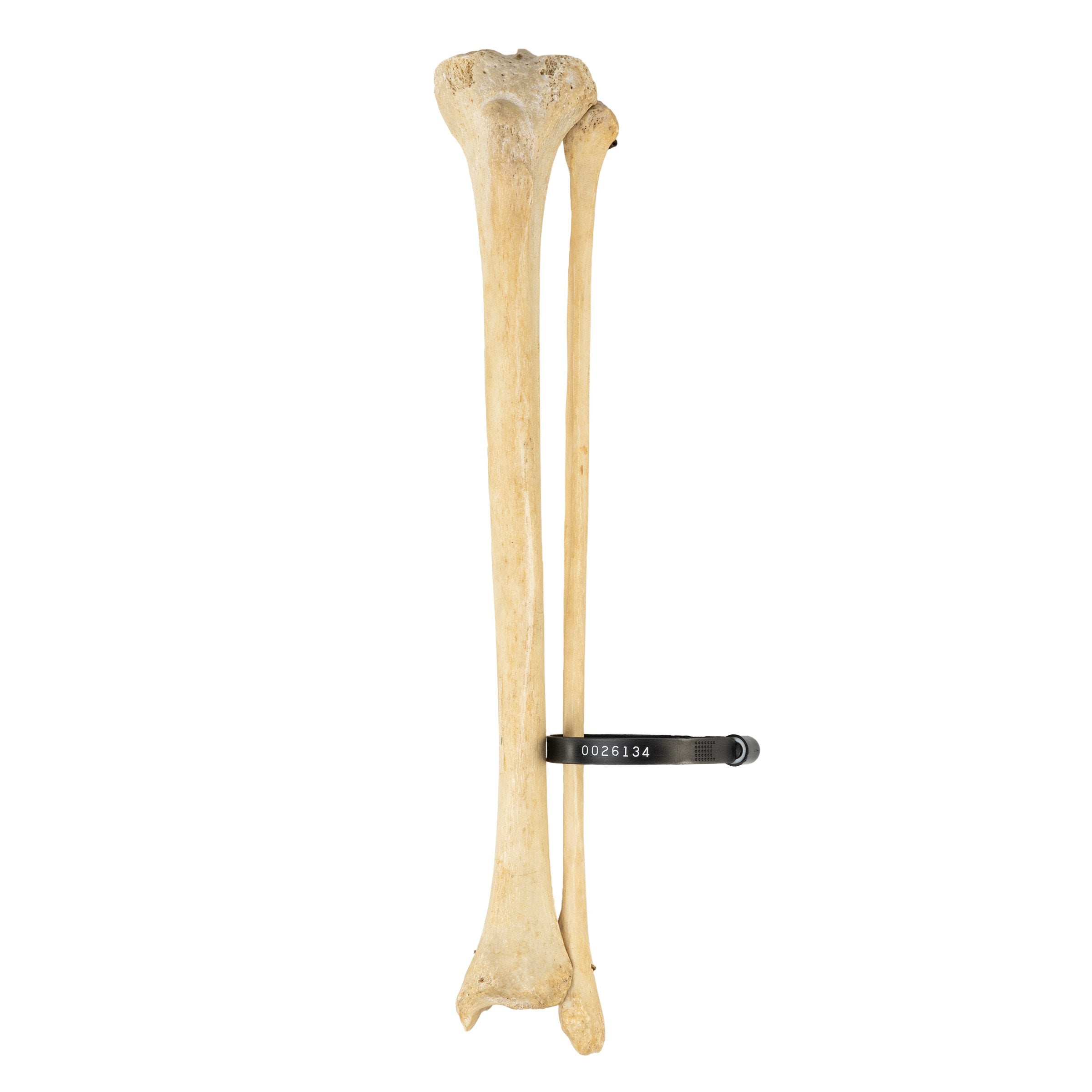 Tibia And Fibula Bones