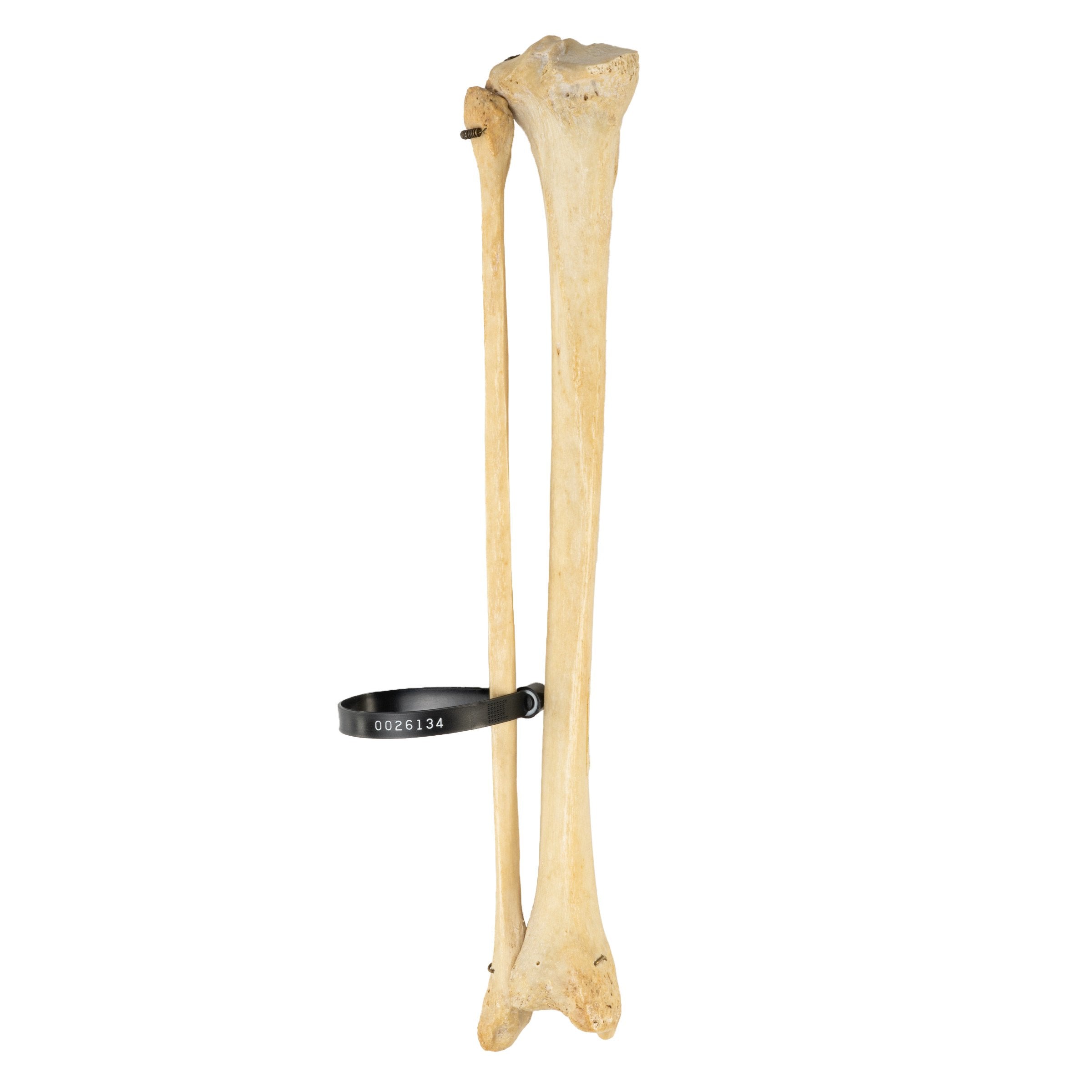 Tibia Bone