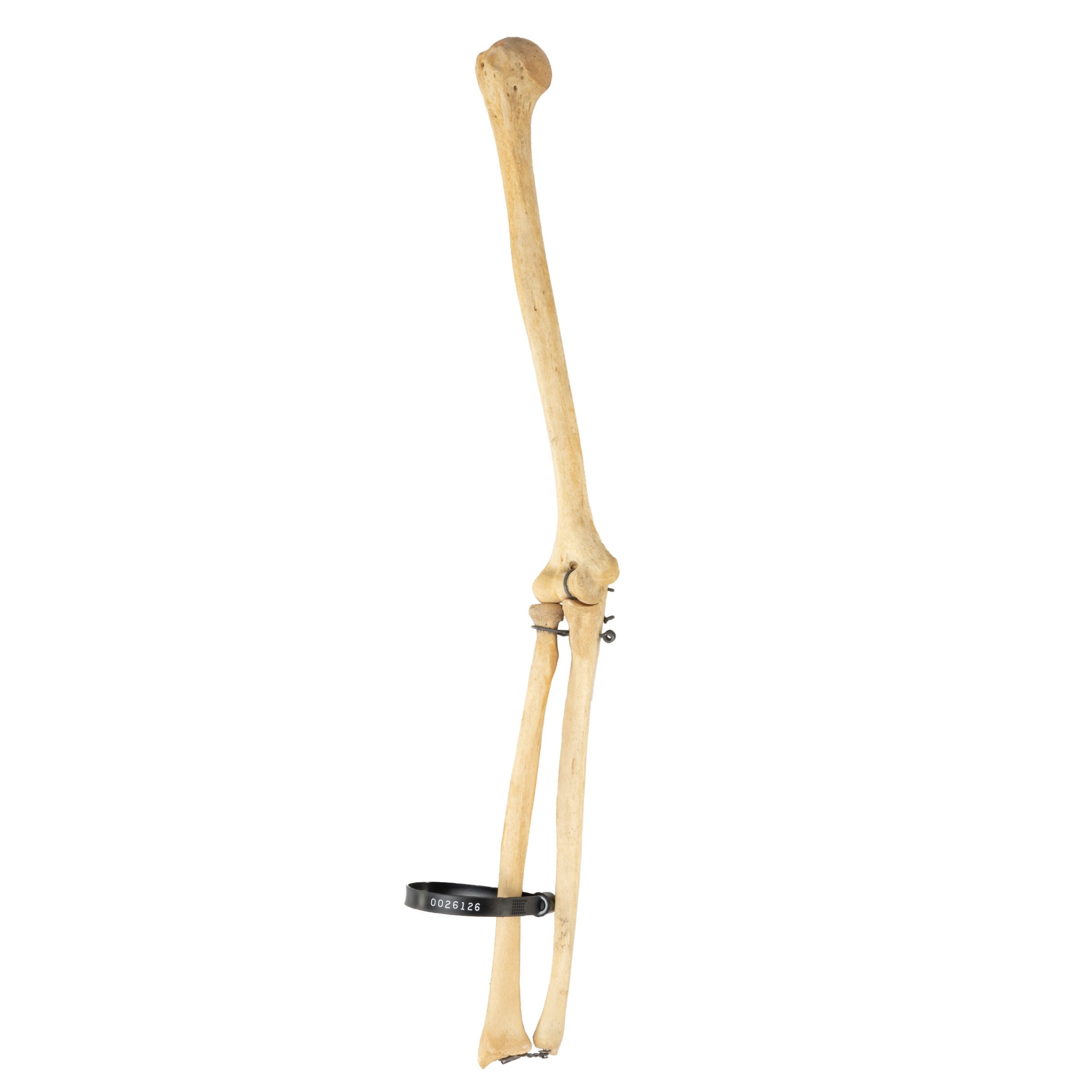 Real Human Arm Bones