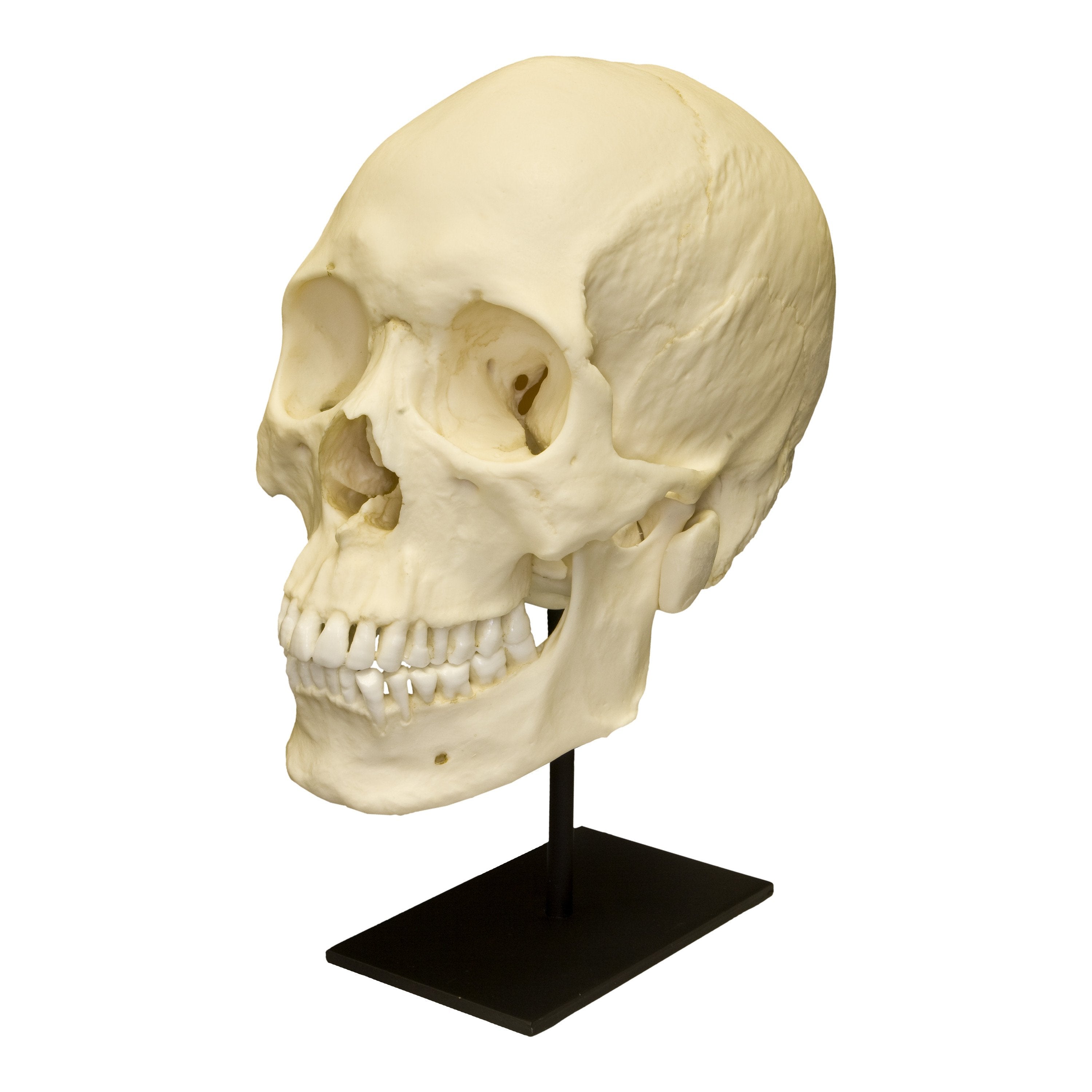 Mongoloid Skull Side