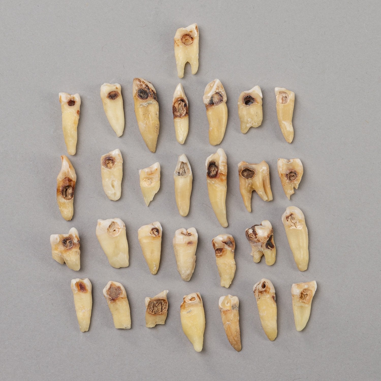 Real Human Teeth