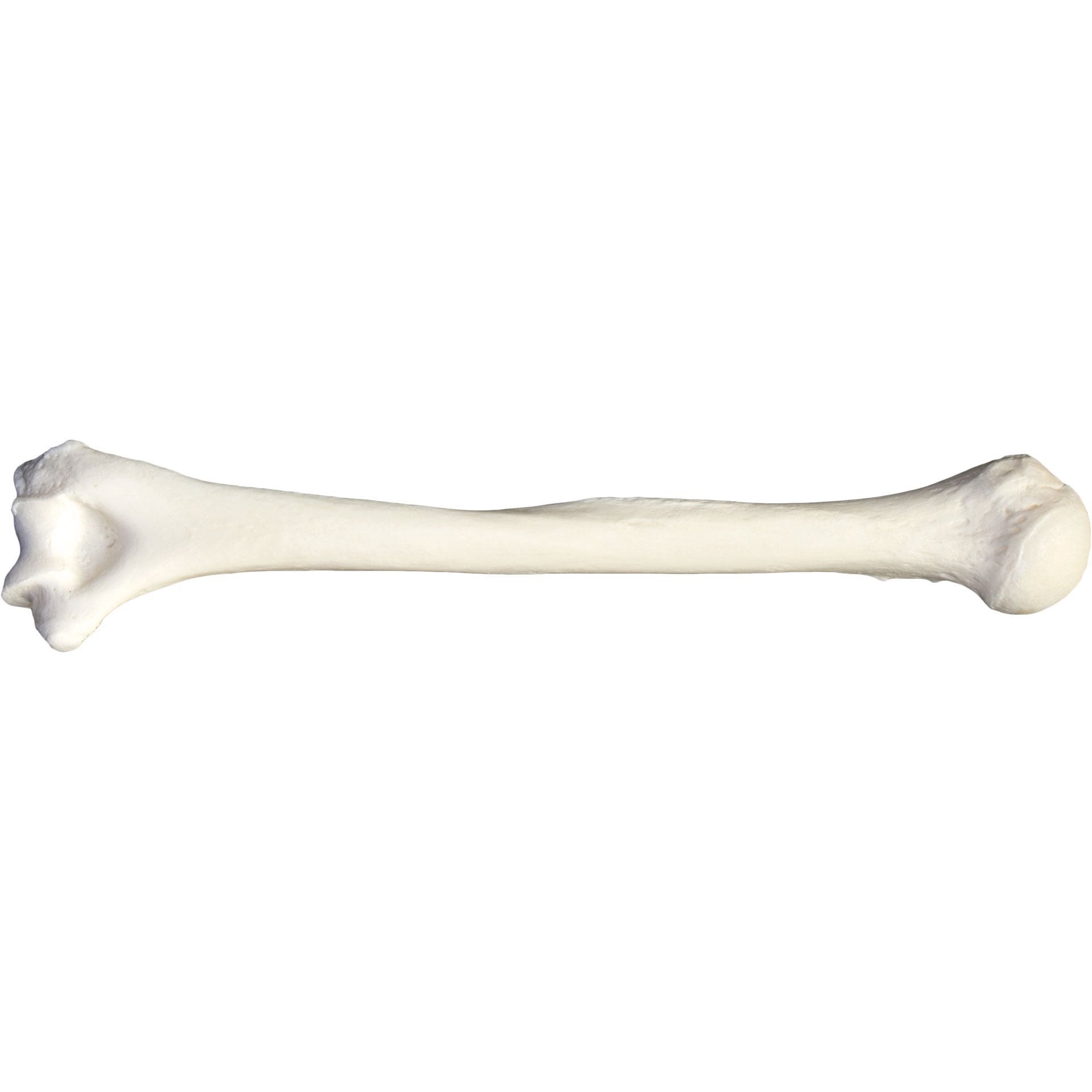 Human Humerus Bone
