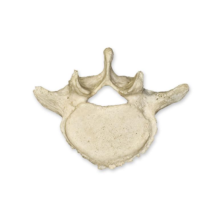 Real Human Lumbar Vertebra - Single — Skulls Unlimited International, Inc.