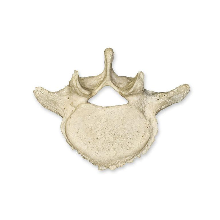 Real Human Lumbar Vertebra - Single — Skulls Unlimited International, Inc.