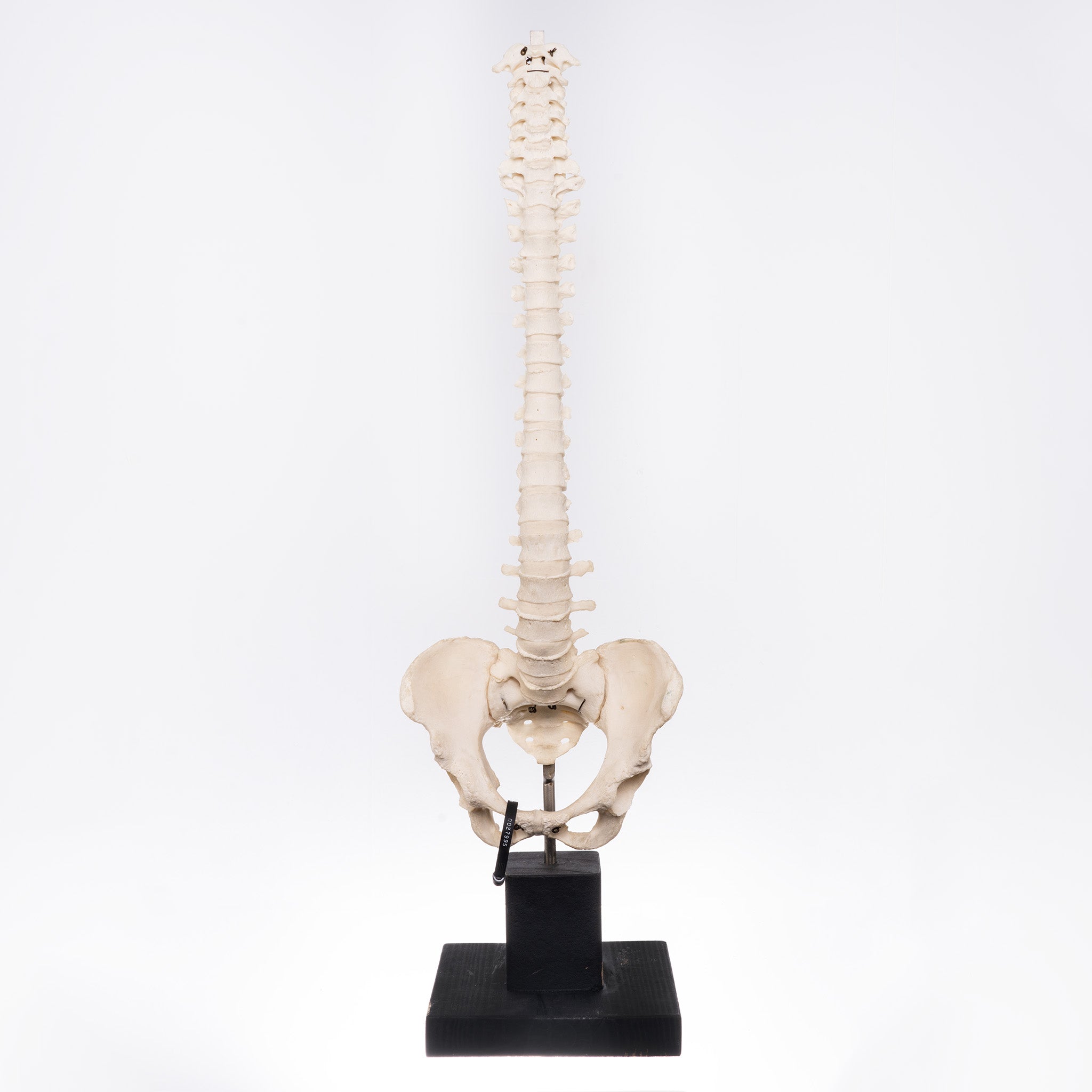 Real Life Spinal Cord